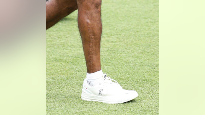 Tiger Woods Reveals Leg Scar For First Time Since 2021 Car Crash | OutKick
