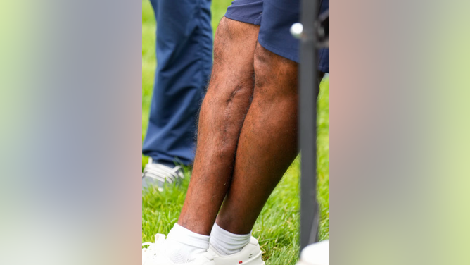 Tiger Woods Reveals Leg Scar For First Time Since 2021 Car Crash | OutKick